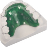 Hawley Retainers | MidLyne Orthodontic Laboratory